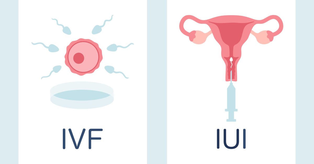 IUI Vs IVF Cost: Price Comparison, Success Rates & Options