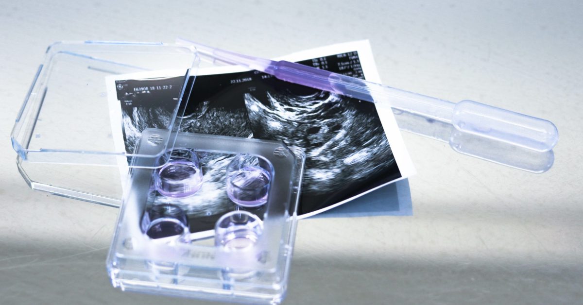 Natural Frozen Embryo Transfer: How It Works