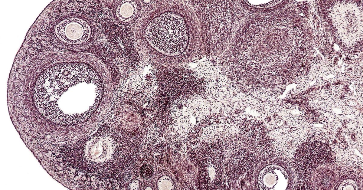 IVF Follicles: Size by Day, and How They Affect Pregnancy Rates