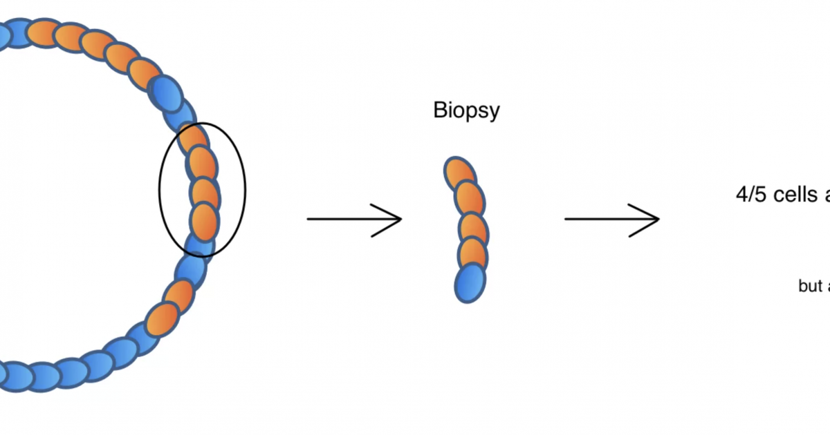 PGT-A: Preimplantation Genetic Testing for Aneuploidy | CNY Fertility
